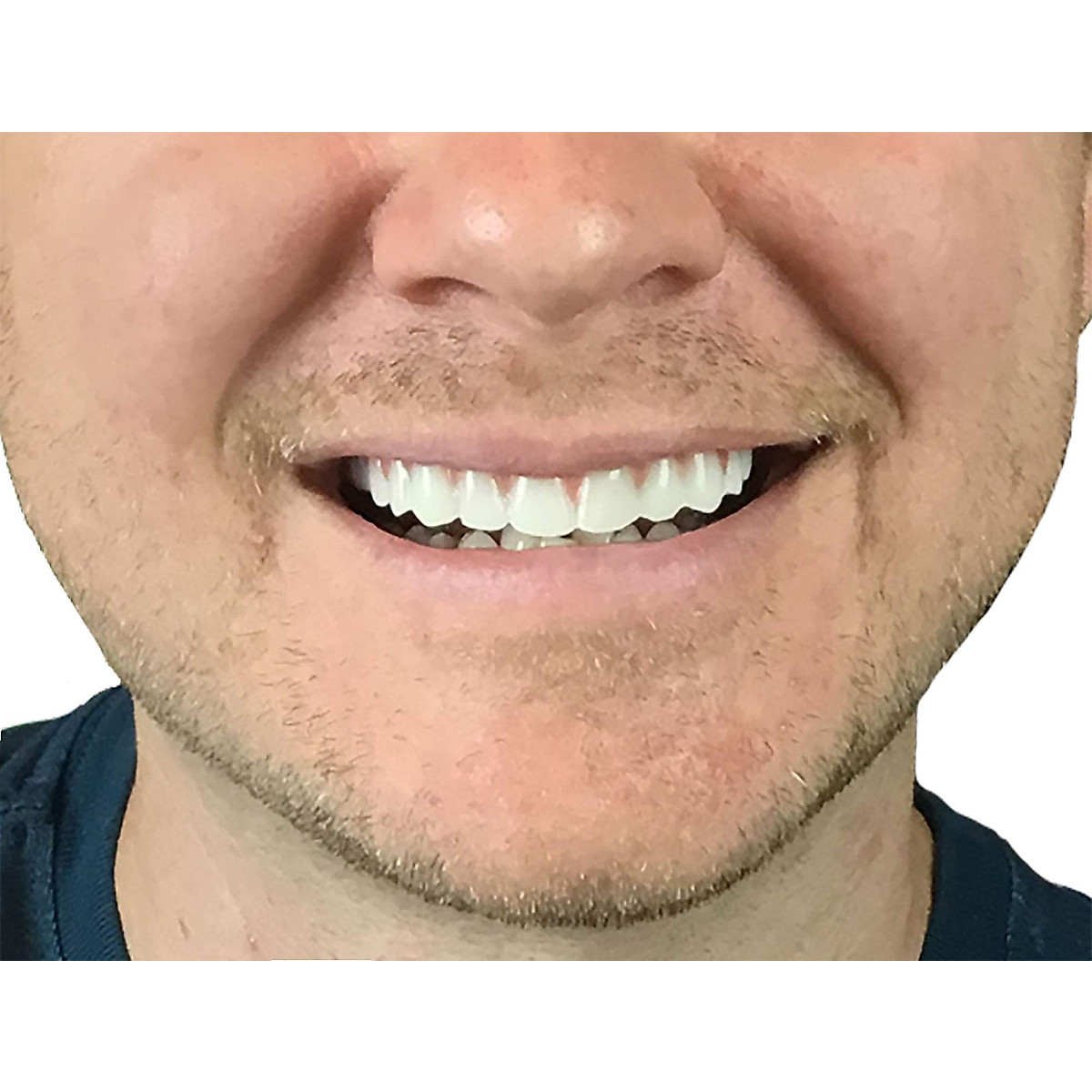 Veneers Teeth for Women and Men Natural Shade Comfort Fit Flex Snap on Veneers for Snap Covering Missing Teeth whitening Replacements Protect Your Teeth and regain a Confident Smile