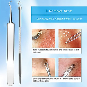 Premium Blackhead Remover, Comedone Blemish Acne Extractor,Popping Pimple Popper Whitehead Removal, Precision Tweezers, Zit Removing, Milia Remove