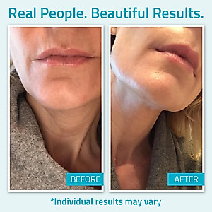 YEOUTH Day Night Cream for Face with Hyaluronic Acid, Snail Mucin and Copper Tripeptide,Hydrating Moisturizer Face Cream for Women and Men 4oz