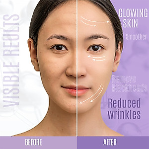 Lift And Firm - 30% Peptide Serum, Matrixyl 3000, Vitamin C & E + Hyaluronic Acid + Aloe Vera, Lifts, Firms & Tightens Skin + Pure Organic Anti-aging Serum (2 Fl Oz)