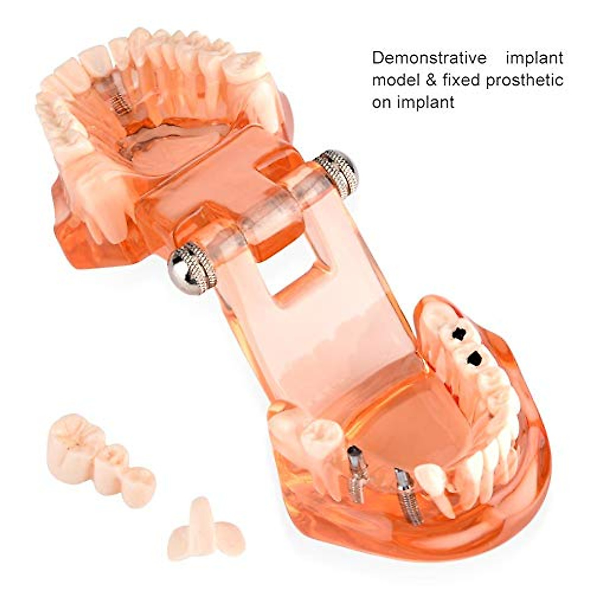 Maxmartt Teeth Model, Dental Demonstration Dental Implant Removable Study Model Teeth Teaching Model for Student Teacher, Orange