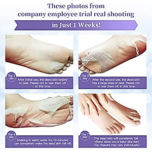 Foot Peel Mask, YOUPINWEI Exfoliating Feet Peeling Mask for Dry Cracked Heels - 2+1 Packs - Make Your Feet Baby Soft Get Smooth Silky Skin, Calluses and Dead Skin Remover for Women and Men
