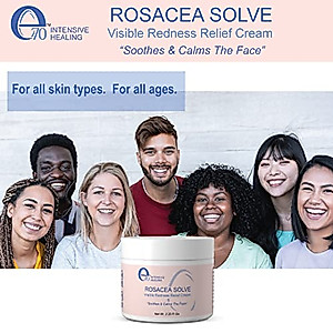 E70 Rosacea Solve - Redness Relief Cream - Calming Face Moisturizer For Rosacea and Acne-Prone Skin - Sensitive Skin Care With Organic Ingredients such as Aloe Vera, Almond Oil, Licorice and Chamomile Extracts - No Parabens