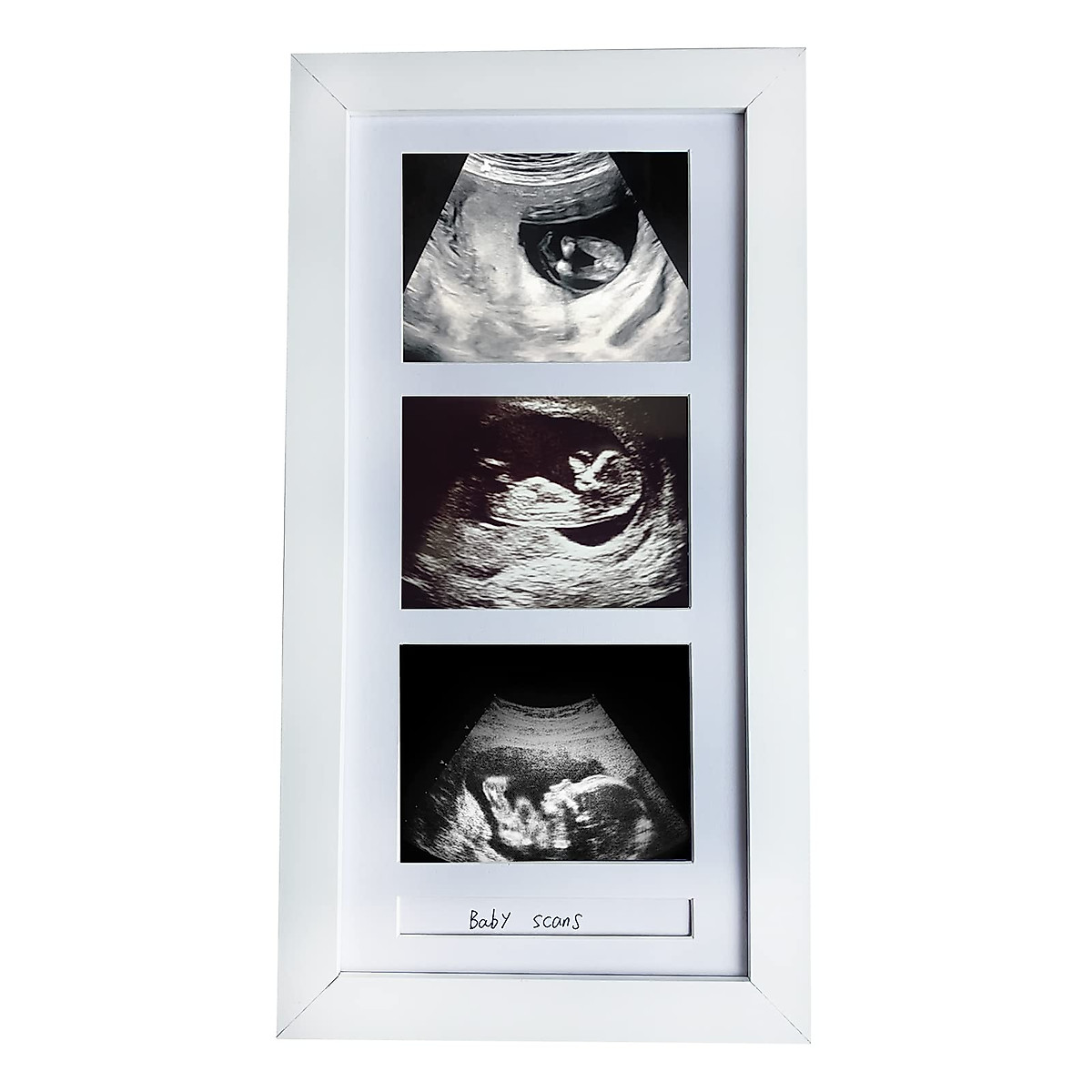 trlry Triple Ultrasound Picture Frames, Sonogram Picture Frame 3 Photos,Pregnancy Announcements,Pregnancy Gifts for First Time Moms,First Time Mom Gift,White,Ultrasound Photo Album