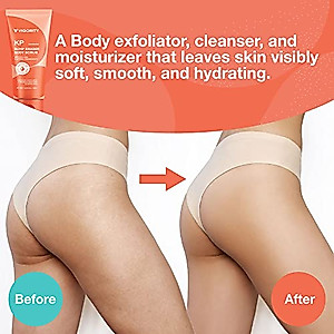 KP Bump Eraser Body Scrub, Body Exfoliating Scrub, Keratosis Pilaris Treatment, Strawberry Legs Treatment, Exfoliating Body Wash, Strawberry Skin Treatment, Scrubs for Women & Men Exfoliation - 8.45OZ