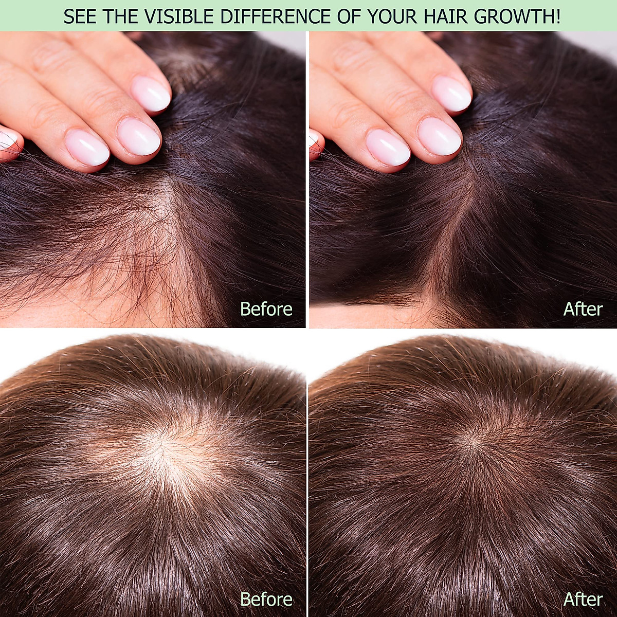 Rice Water For Hair Growth, All Natural Vegan Leave in Conditioner Spray Hair Care Products for Woman&Men, Biotin Infused Leave In Conditioner. Rice Water Hair Mist For Dry, Frizzy, Weak, Damaged Hair - Strengthen, Moisturize & Thicken Hair Naturally - 4o