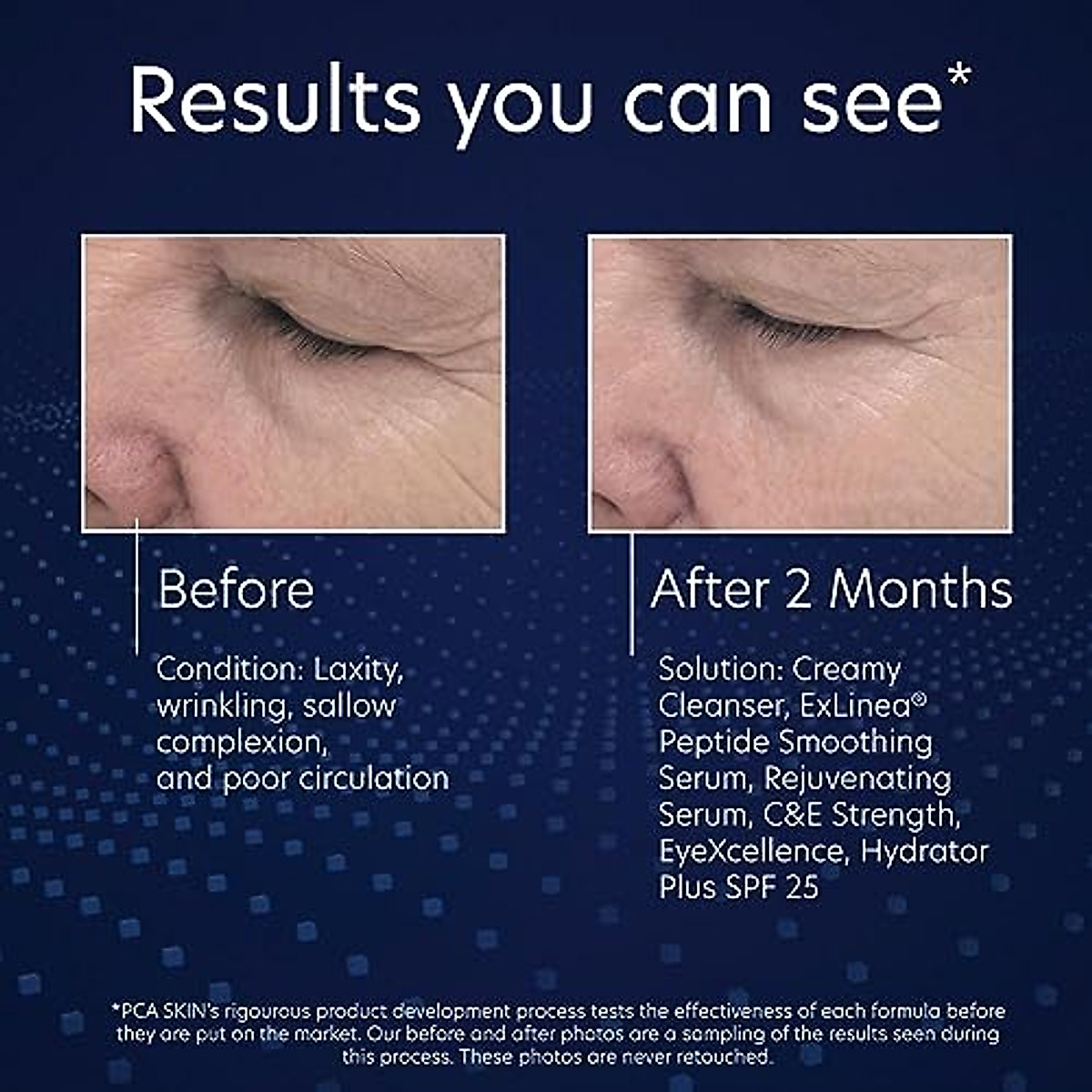 PCA SKIN ExLinea Peptide Smoothing Face Serum, Spot Treatment for Face Serum, Firms Aging Skin, 1.0 fl oz Pump