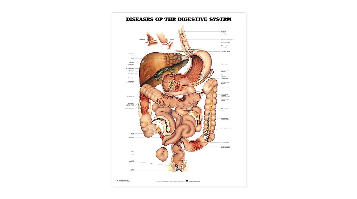 Diseases of the Digestive System Chart | Anatomical Educational Poster