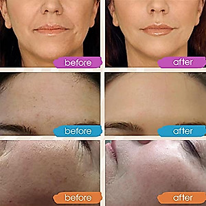 INTRODUCTORY OFFER - Retinol Serum for Face - Vitamin C Face Serum with Hyaluronic Acid Serum for Face, Retinol Face Anti Aging Serum, Vitamin C Serum for Face, Glow Face Serum for Women 3x1 fl GLEOW