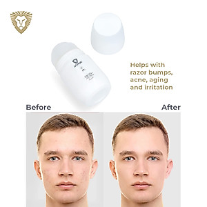 Leovard- Men & Women Razor Bump and Ingrown Hairs Serum - After Your Shave Solution Roll-On for Ingrown Hairs, Razor Bumps, Irritation, Blemishes and Discoloration