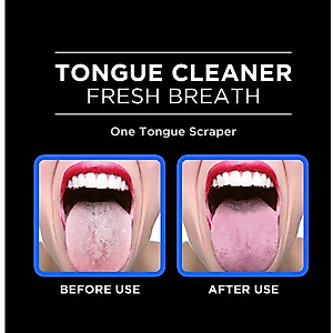 5 Pack Tongue Scraper Brush, Tongue Scraper, Tongue Cleaner, Tongue Brush, Tongue Scraper Cleaner, Tongue Brushes, Helps Fight Bad Breath, 5 Tongue Scrapers