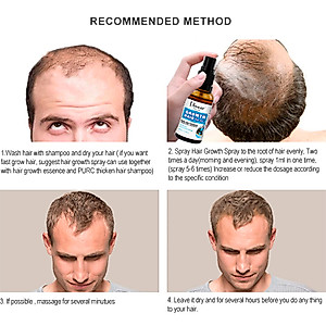 DISAAR Beauty Growth Hair Oil Spray Repair Follicles Strengthen Hair Root DHT Blocker Nourishing 30ml / 1.01fl.oz