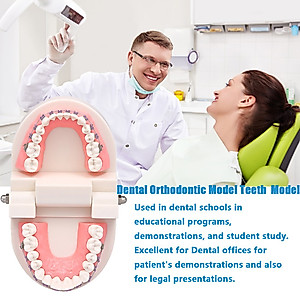 Angzhili 1 Piece Dental Demonstration Orthodontic Model with Metal Wires and Bracket (Metal bracket)