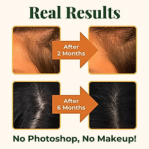 Heebin's Hair Growth Supplements with Biotin 4000 mcg, DHT Blocker and Collagen, for Hair Loss, Thinning and Regrowth, 60 Tablets, 2 Month Supply