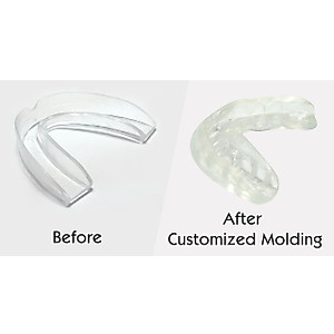 Mouth Guard for Grinding Teeth - 2 Pack, Made in USA, Thin and Trim Anti Grinding Night Guard - Teeth Whitening Dental Tray, Stops Bruxism - Teeth Clenching, No BPA