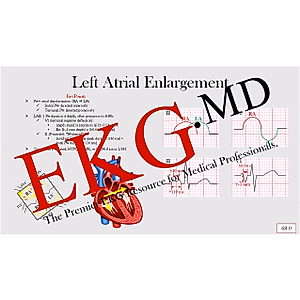 Ultimate EKG Breakdown - The EKG Guy