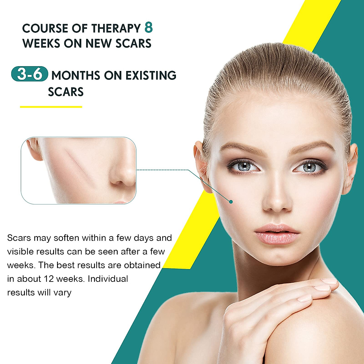 Pumkot Silicone Scar Sheets, Silicone Scar Tape(1.6” x 120” Roll-3M), Scar Removal Away Strips for Surgical Scars, Keloid, C-Section, Burn et