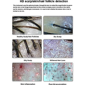 MAHWER USB WiFi Skin Diagnosis Hair Analyzer with 50X/200X Switch Freely Dual Probe, 4 Picture/Video Comparison, Scientific Analysis 1080P Skin Follicle Detector
