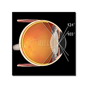 Volk Optical Digital Wide-Field Indirect Ophthalmic Slit Lamp Lens - Blue