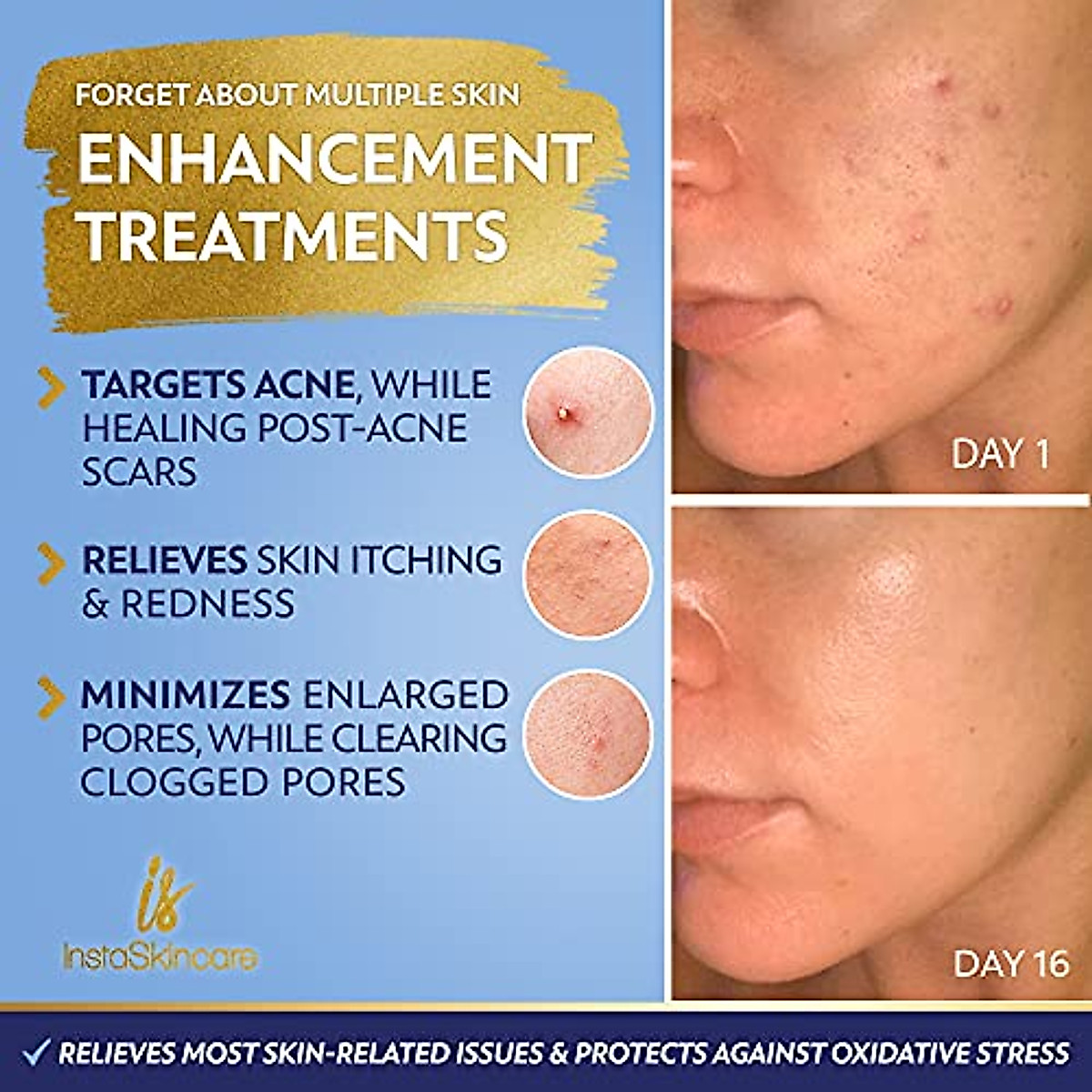 DOUBLE SIZED (2Oz) Niacinamide Serum for Face 10% with Zinc 1% Vitamin B3 Facial Serum Brightening Serum for Acne Pore Minimizer and Dark Spot Remover