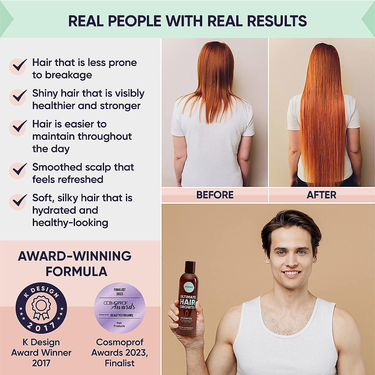 Moerie Ultimate Hair Growth Shampoo – For Longer, Thicker, Fuller Hair - Vegan Friendly Volumizing Hair Products – Paraben & Silicone Free – All Hair Types – Reverse Hair Loss – 8.45 fl oz (250ml)