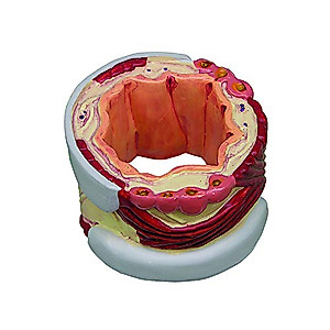 GPI Anatomicals - 4-Piece Bronchus Model | Human Body Anatomy Replica of Respiratory System w/Conditions for Doctors Office Educational Tool