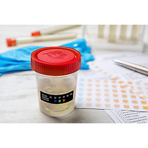 Urine Temperature Strip, Temperature Label for Drug Screening, Audit Check - Fahrenheit, 62 Pieces