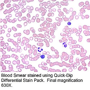 Quick-Dip Differential Stain Pack, 500ml