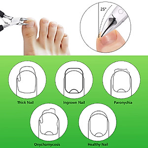 Feiccier Heavy Duty Ingrown Toenail Clippers, Professional Toenails Trimmer, Podiatrist Toe Nail Clippers for Thick Nail & Ingrown Toenails, Sharp Curved Blade, Pedicure Tools.