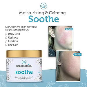 Era Organics Cream Redness Relief Moisturizer- Soothing Redness Relief for Face with Manuka Honey, MSM, Chamomile - Calming Moisturizer for Face - Redness Face Cream Made in USA