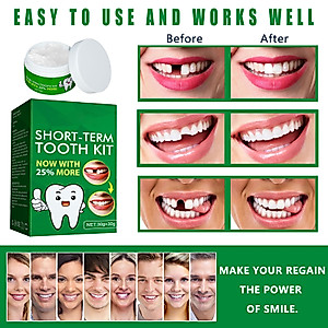 Moldable False Teeth, Tooth Replacement Kit,Temporary Teeth Repair Kit,Tooth Repair Kit for Snap On Instant and Confident Smile,with Mouth Mirror, 3 Pcs Differernt Dental Probe