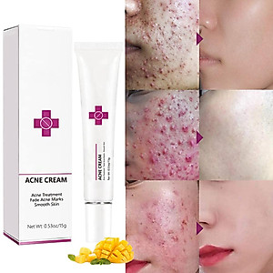 Acne Cream Pimple Cream for Face, Oil Control Pimple Remover Cream Get Rid of Pimples Fast,for Oily and Acne Prone Skin, Cruelty Free, Crema para espinillas en la cara