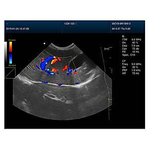 CONTEC CMS1700A-VET/Veterinary Color Doppler ultrasonic Systems (Rectal Linear, Convex Probe)