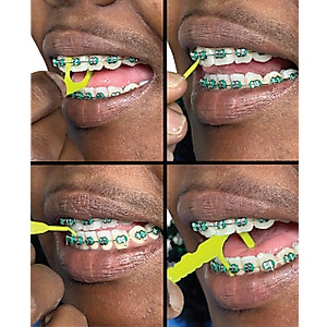 LBailar Braces Toothbrush Rechargeable with 4 Heads Bonus 2 AFTERCARE