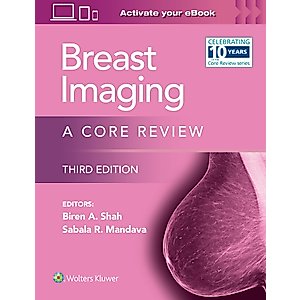 Breast Imaging: A Core Review: Print + eBook with Multimedia (The Core Review)