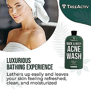 TreeActiv Acne Exfoliating Body Wash, 8oz, Foam Cleanser for All Skin Types, Sulfur, Aloe Vera, Jojoba Beads