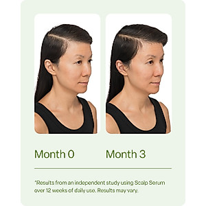 Divi Hair Scalp Serum for Women and Men - Revitalize and Balance Your Scalp - Improves Appearance of Thinning Hair, Nourishes the Scalp and Helps Remove Product and Oil Buildup, 100ml