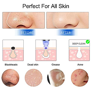 2023 Blackhead Remover Pore Vacuum Cleaner Electric Blackhead Vacuum Extractor Pore Cleaner Comedone Whitehead Remover Kit Pore Extractor Suction Too with 5 Different Sucker Heads