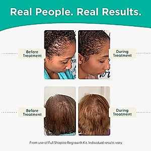 Women's Regrowth Kit Plus: Shampoo, Conditioner, 2% Minoxidil, Leave-In Foamer. Anti Hair Loss and Thinning Hair Solution for Women, 1 Month