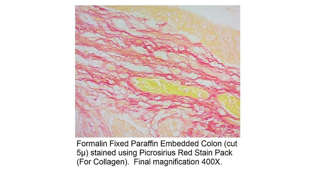 Picrosirius Red Stain Pack for Effective Collagen Staining
