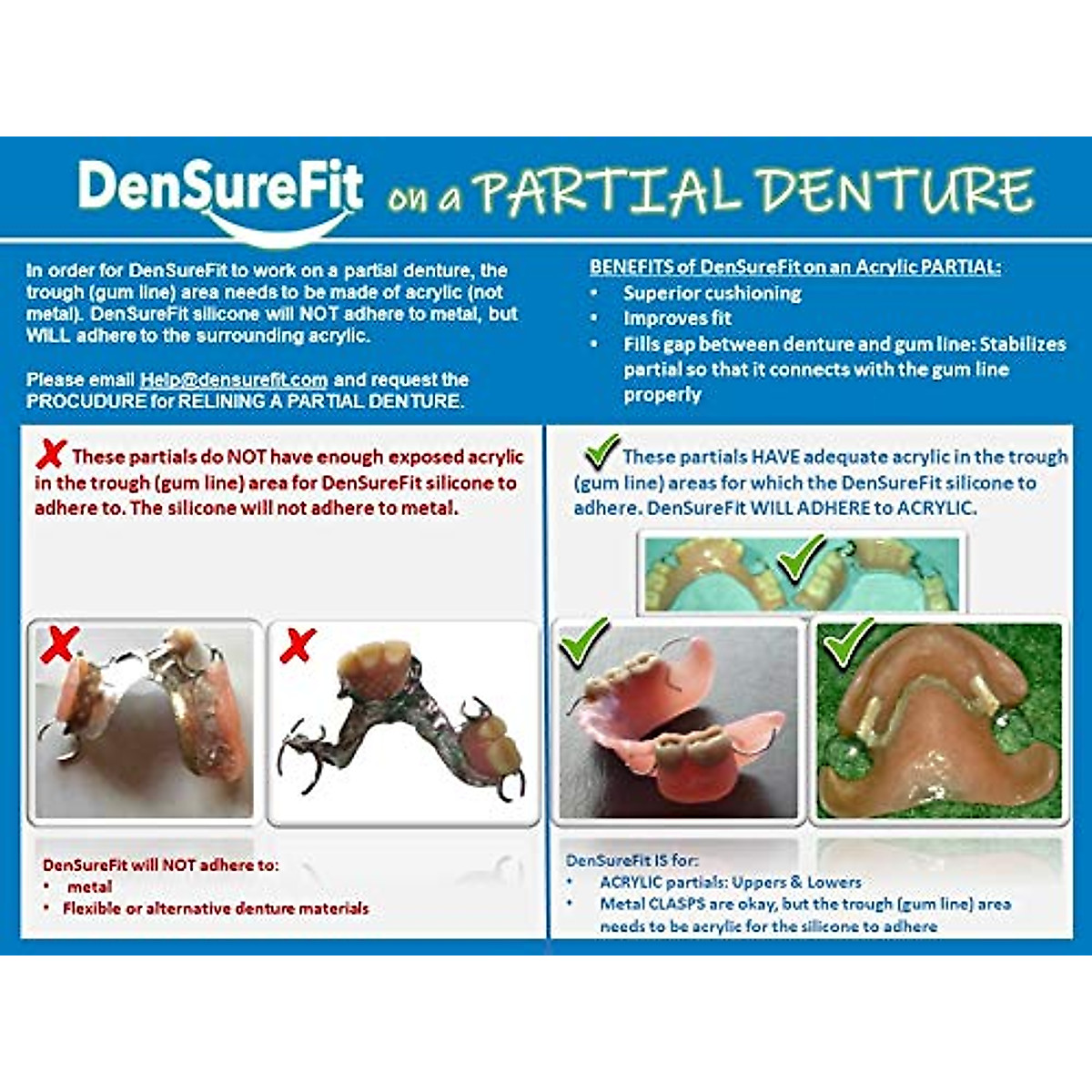 DenSureFit Lower Denture Reline Kit, Unflavored