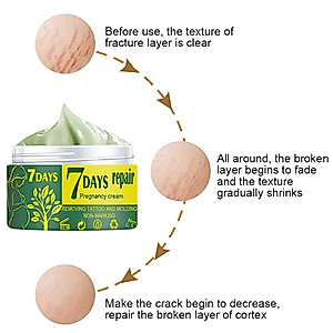 Hotiary Maternity Stretch Mark 7 Days Repair Cream Removing Tatoo Molding Non-marking Pregnancy Obesity Skin Postpartum Stretch Scar Body Marks Remover Smooth Skin Care 1.67 oz