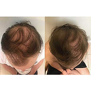 Zenagen Revolve Thickening Hair Loss Treatment for Men, 6.75 Fl Oz