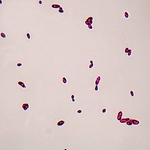 Candida Albicans, W.M. Microscope Slide
