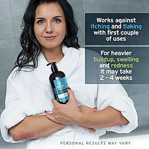 Severe Flaky Psoriasis Natural Serum and Shampoo 13.5 fl oz with Salicylic Acid Set