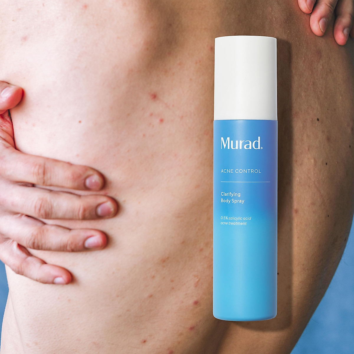 Murad Clarifying Body Spray - Acne Control Salicylic Acid Treatment - For Clearing Body Acne, 4.3 fl oz