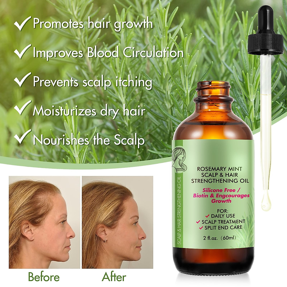 Rosemary Essential Oil (2 fl oz),Rosemary Oil for Hair Growth & Skin Care,Dry Scalp Treatment, Hair Growth Serum for Hair,Organic Hair Oil