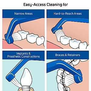 TEPE Angled Soft Bristle Toothbrush, Orthodontic Toothbrush for Braces, Small Head Toothbrush for Retainers, Implants, Universal Care, 1 Pk