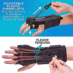 BraceAbility Radial Nerve Palsy Splint - Dynamic Wrist Drop and Limp Finger Extension Brace for Saturday Night, Honeymoon, and Crutch Palsy Treatment (One Size)
