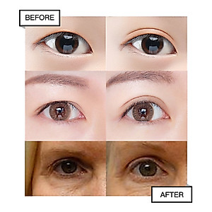 400Pcs Natural Invisible Single Side Eyelid Tape Stickers Medical-use Fiber Eyelid Lift Strip, Instant Eye Lift Without Surgery, Perfect for Uneven Mono-Eyelids, 100 Pairs Slim + 100 Pairs Wide